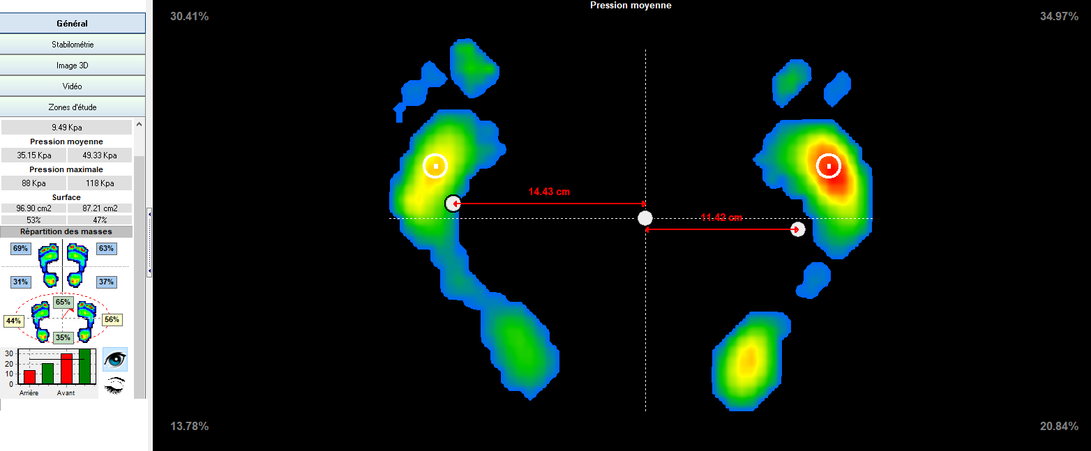 Le bilan podologique - PODO MOUV - cabinet de podo-orthèse Valence